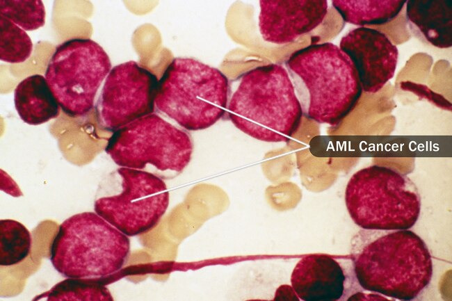 2.9.2 Dimensionality Reduction - Biodata Science